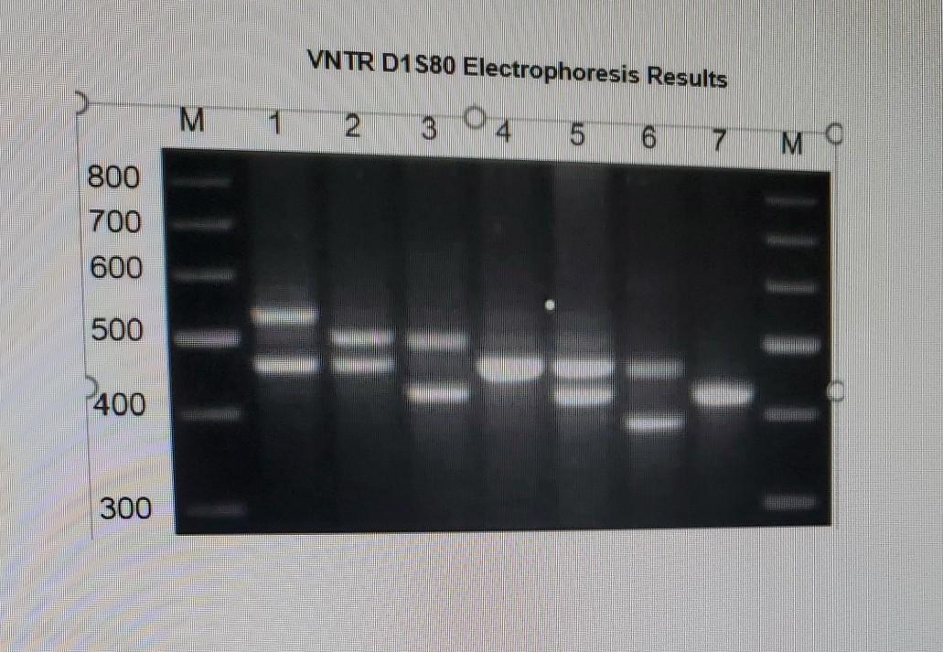 Solved 2. Below is the gel of VNTR with the DNA ladder | Chegg.com