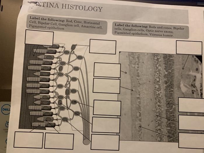 Solved OPTIC CHIASM Chapter 14 Lab homework Label the | Chegg.com