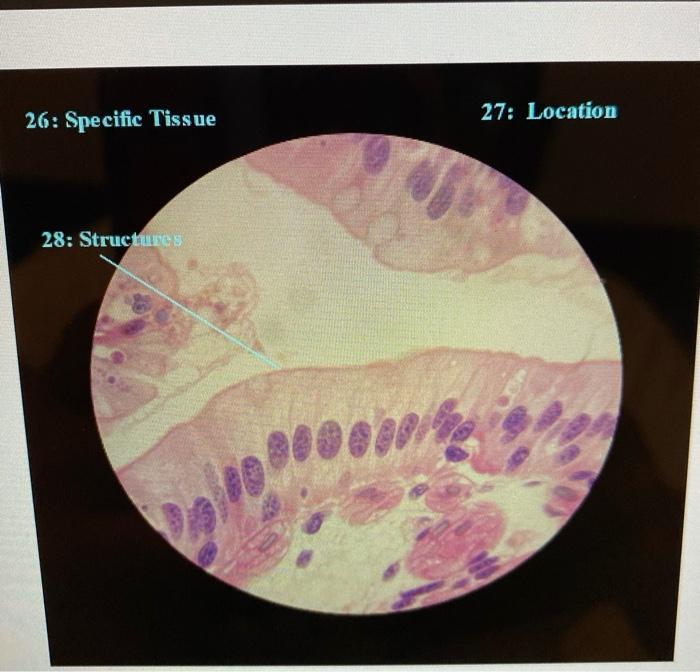 Solved 27: Location 26: Specific Tissue 28: Structures | Chegg.com