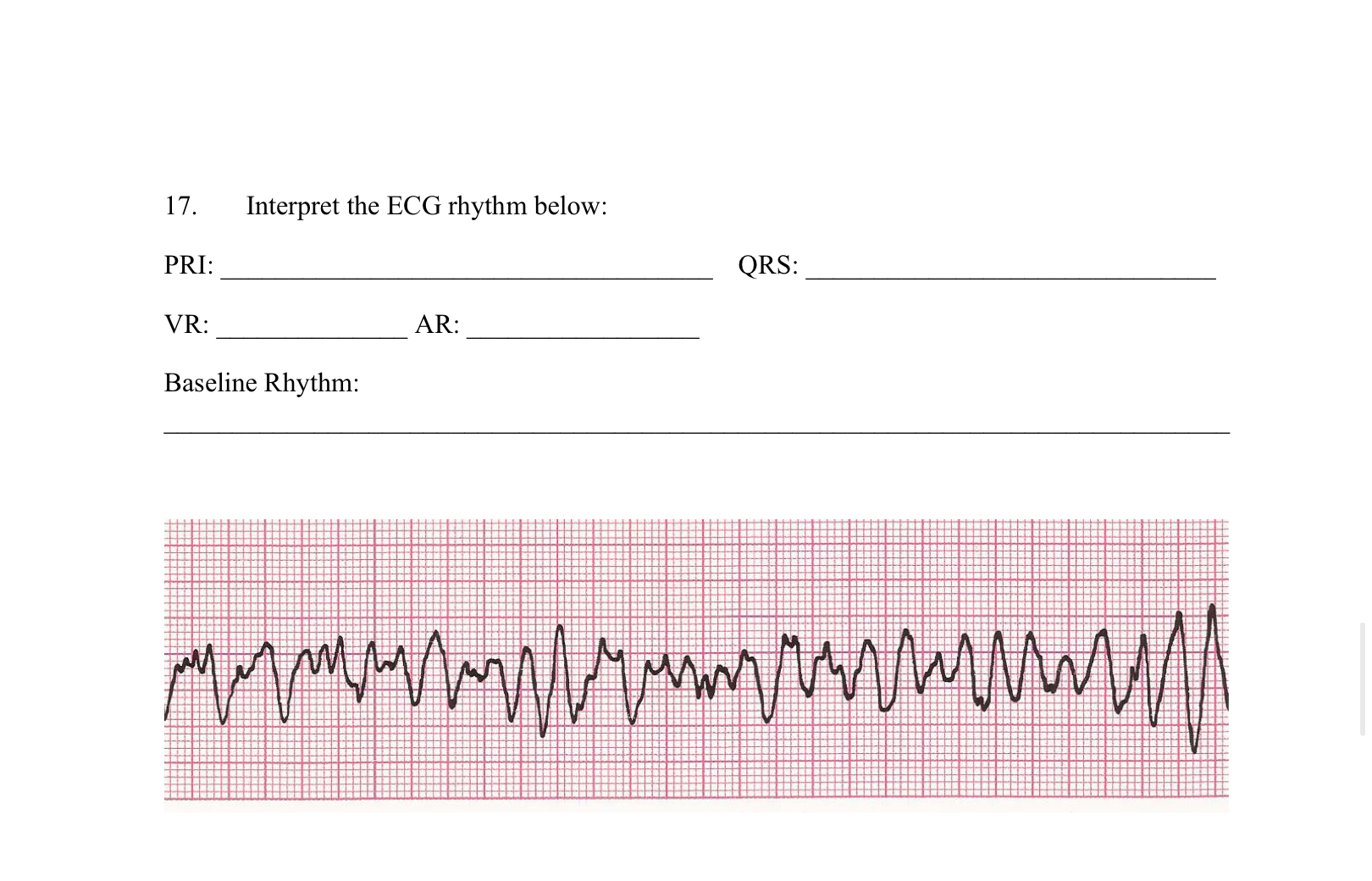 Solved Interpret the ECG rhythm below:PRI:QRSVentrivular | Chegg.com
