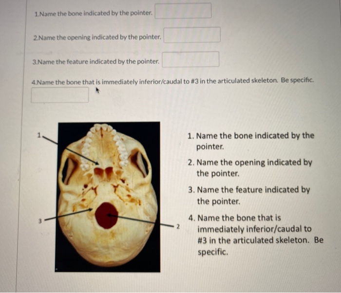 Solved 1.Name the bone indicated by the pointer. 2.Name the | Chegg.com