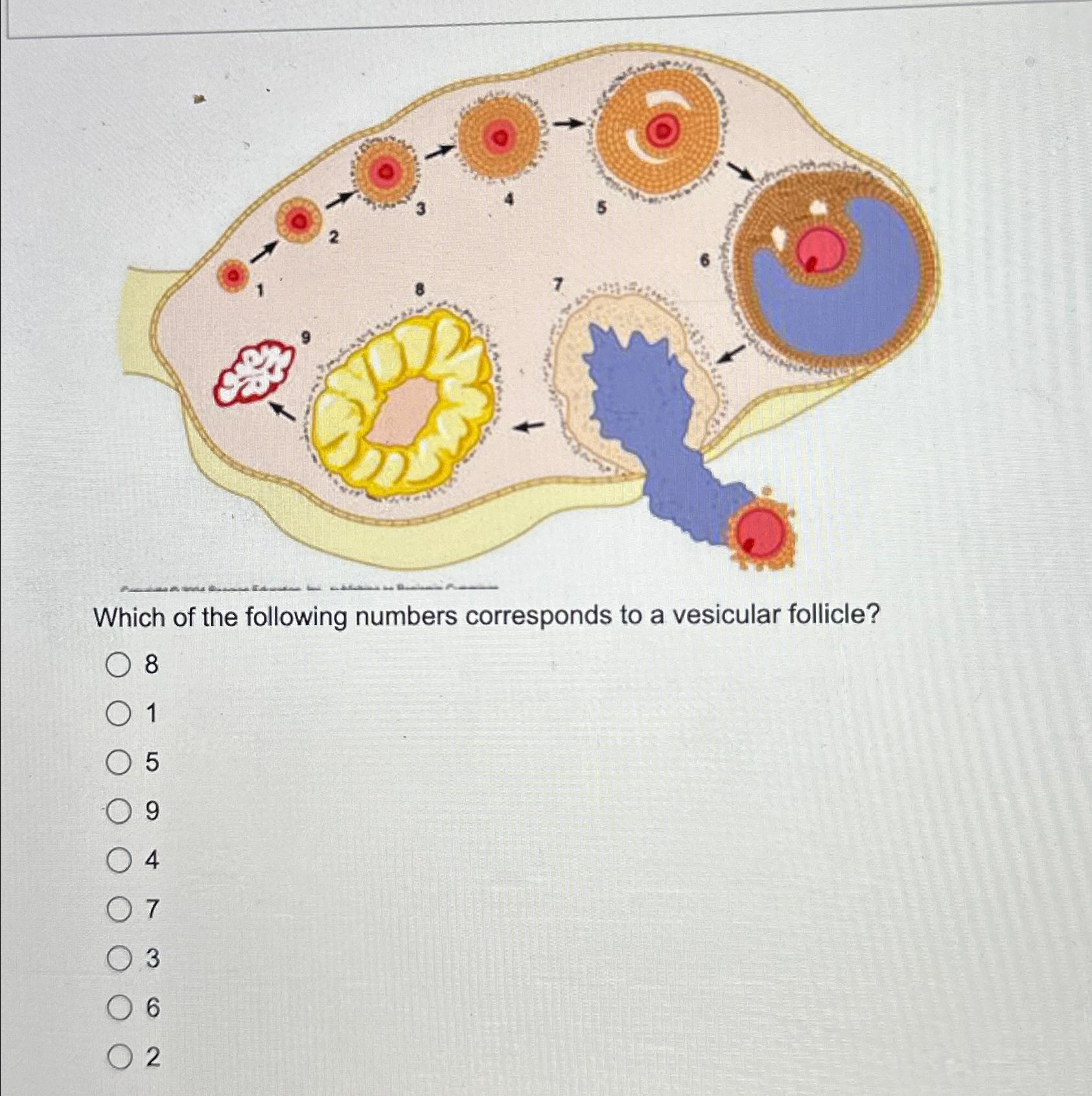 Solved Which of the following numbers corresponds to a | Chegg.com