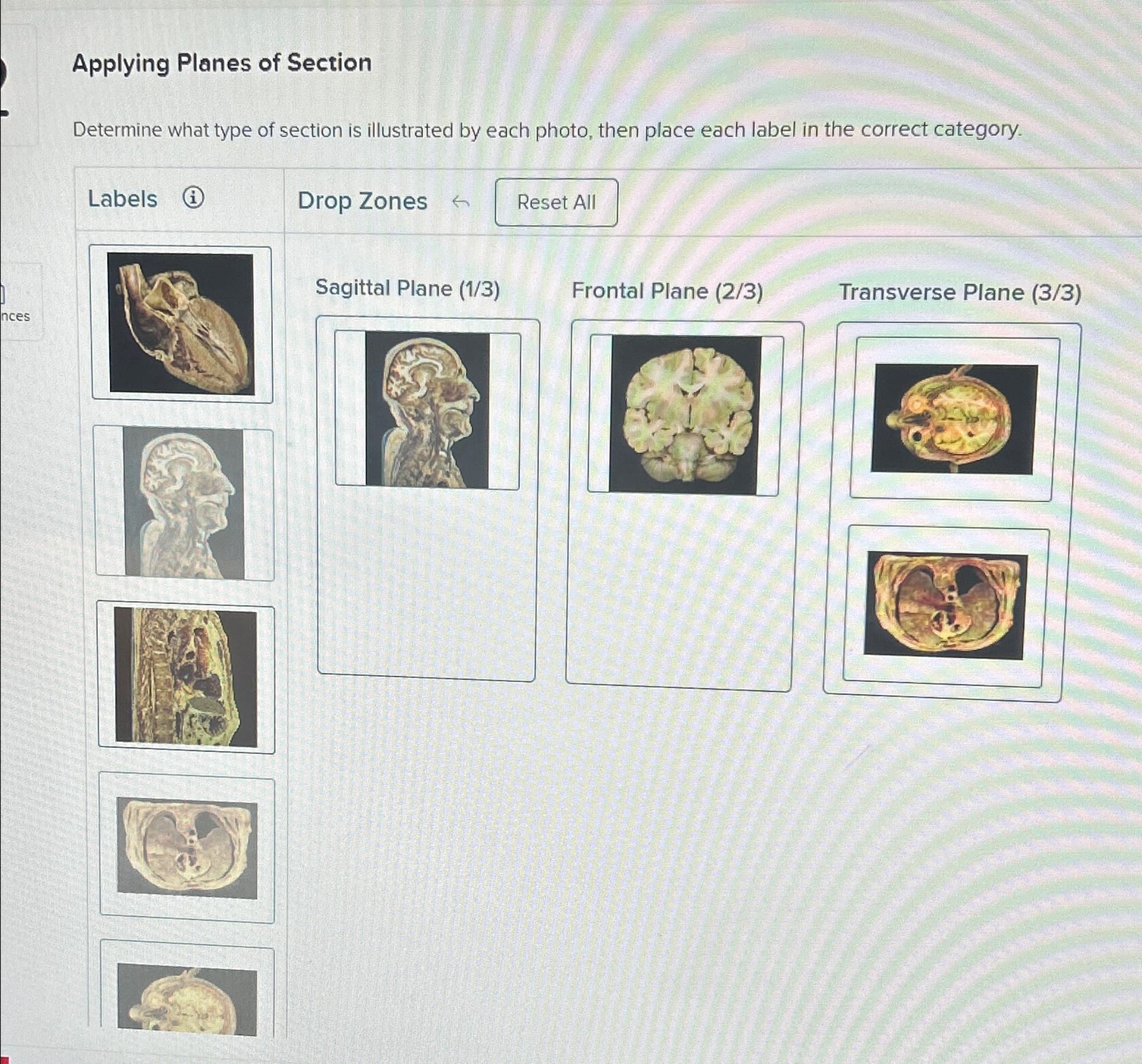 Solved Applying Planes of SectionDetermine what type of | Chegg.com