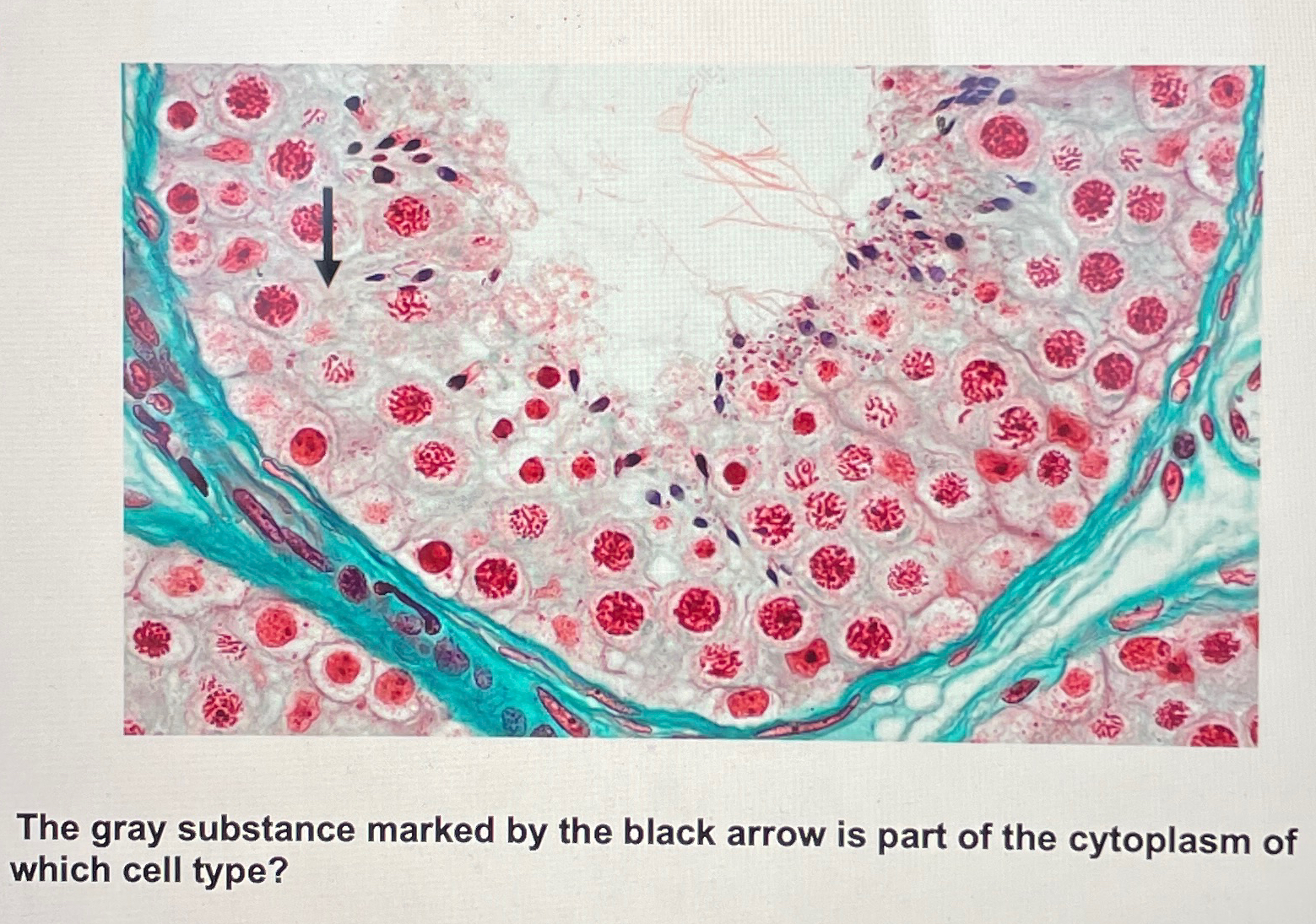 Solved The gray substance marked by the black arrow is part | Chegg.com