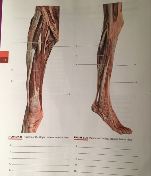 Lower Limb Muscles Cadaver Lower Limb Muscles Cadaver