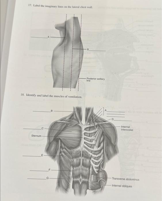 Solved 17. Label the imasinary lines on the lateral chest | Chegg.com