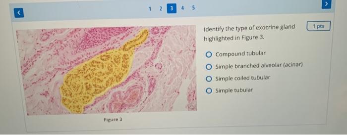 Solved 1 2 3 4 5 1 pts Identify the type of exocrine gland | Chegg.com