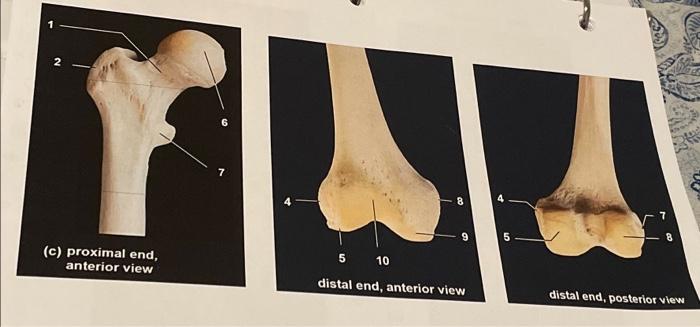 2 (c) proximal end, anterior view 6 5 10 8 distal | Chegg.com