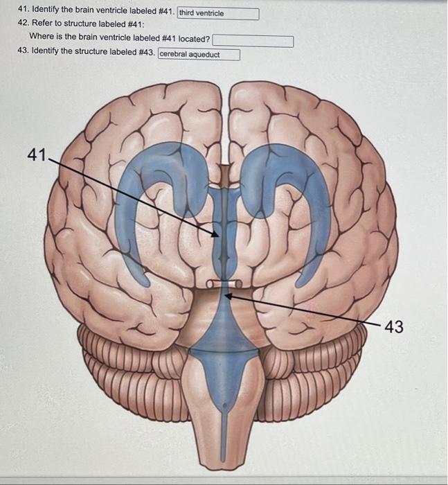 Solved 41. Identify the brain ventricle labeled #41. third | Chegg.com