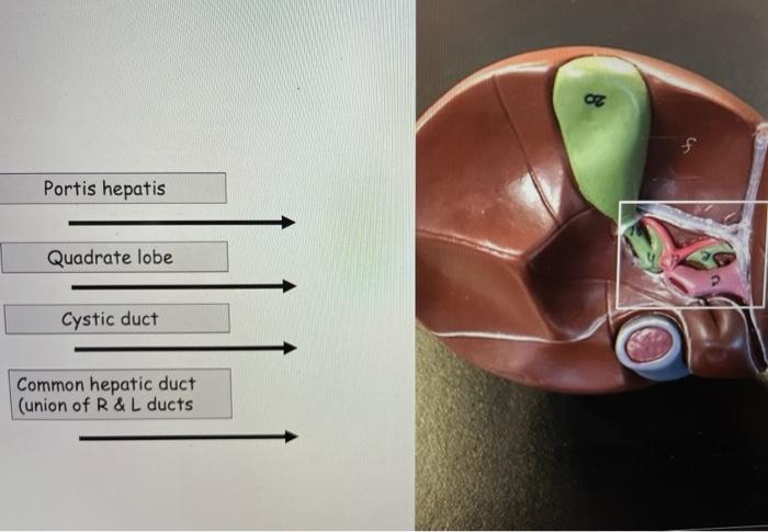 Solved Plicae circulares Greater duodenal papillae OZ of | Chegg.com