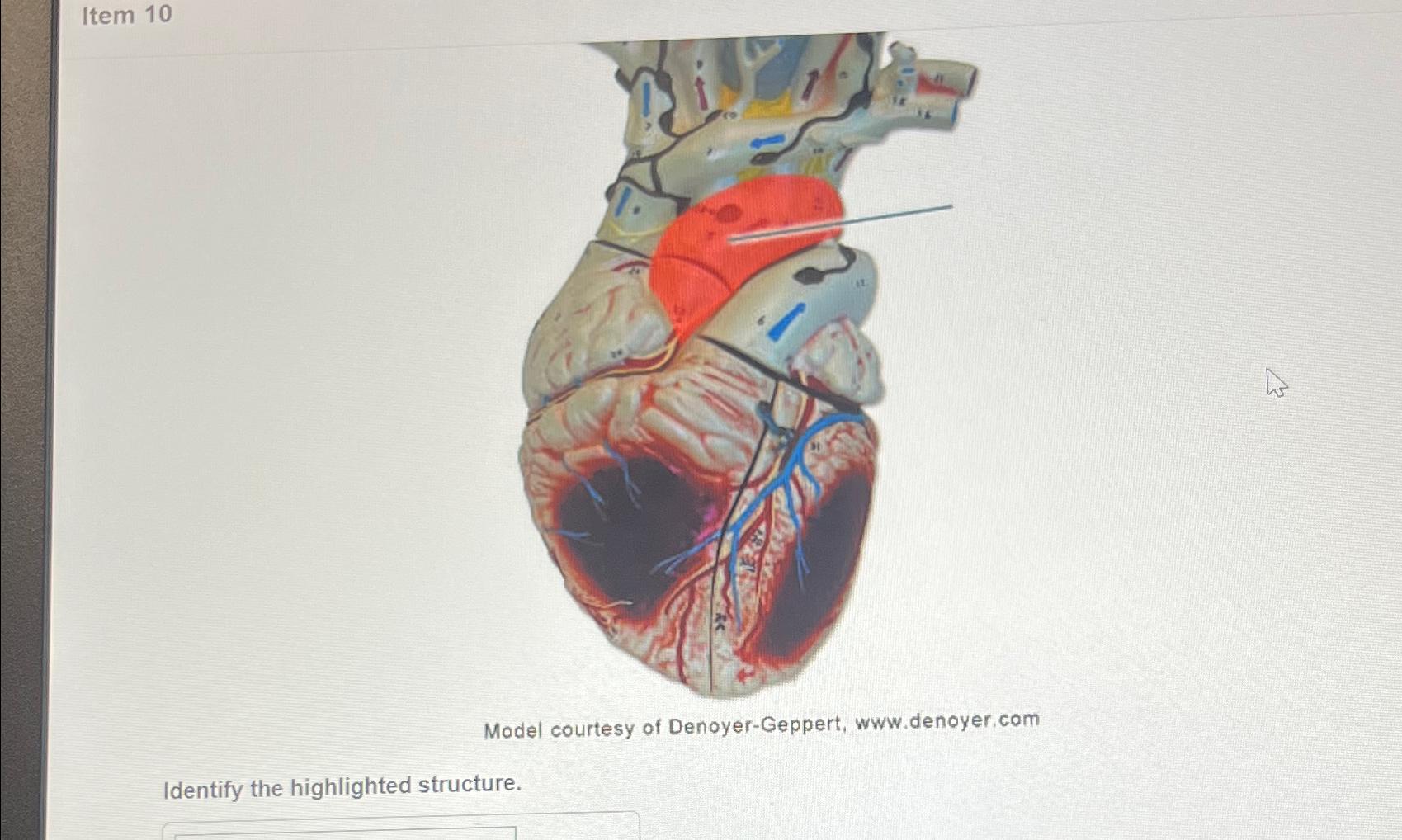 Solved Item 10Model courtesy of Denoyer-Geppert, | Chegg.com