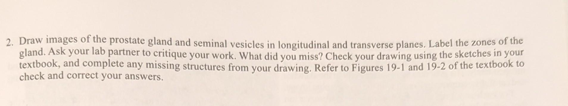 2. Draw images of the prostate gland and seminal | Chegg.com