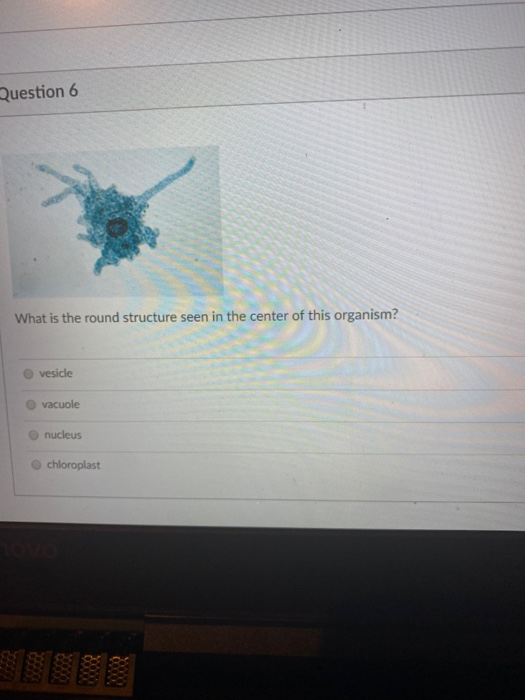 Solved Question 6 What is the round structure seen in the | Chegg.com