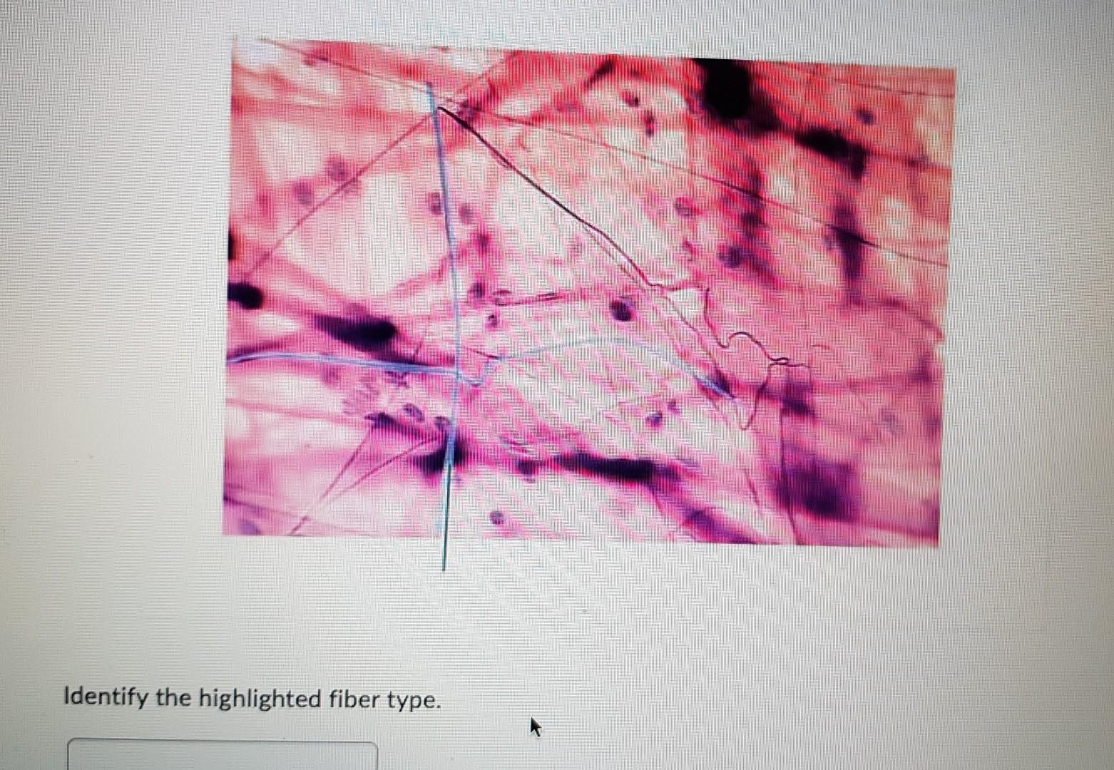 Solved Identify the highlighted fiber type. | Chegg.com