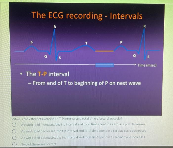 Solved The ECG recording - Intervals R R P T Q Q s s Time | Chegg.com