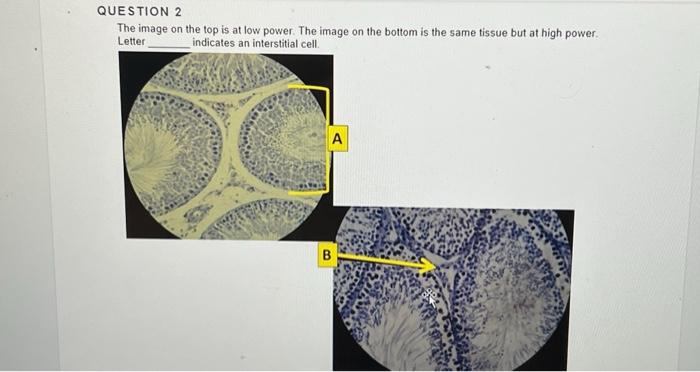 Solved The image on the top is at low power. The image on | Chegg.com