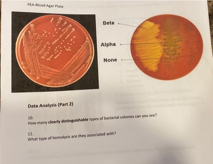 Solved PEA-Blood Agar Plate Beta Alpha None Data Analysis | Chegg.com
