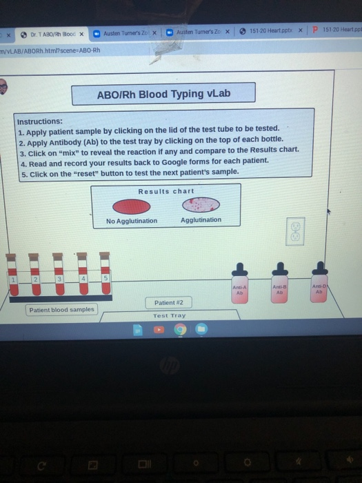 1 point 1. Based on the ABO blood type vLab that you | Chegg.com