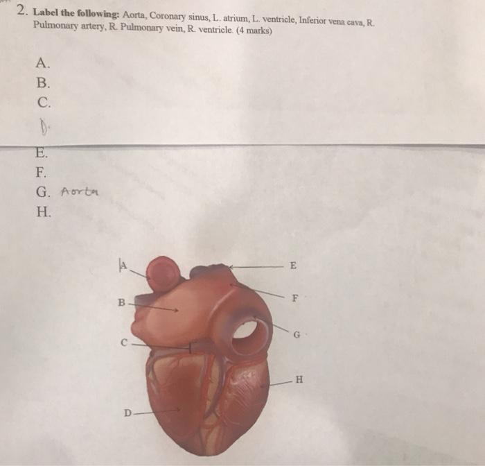Solved 2. Label the following: Aorta, Coronary sinus, L. | Chegg.com