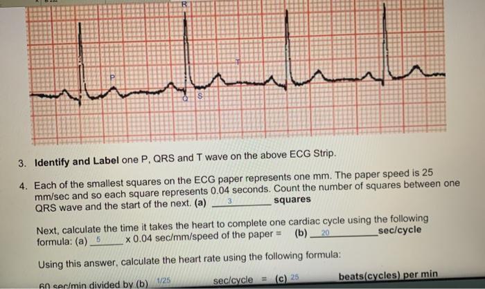 Solved 3. Identify and Label one P, QRS and T wave on the | Chegg.com