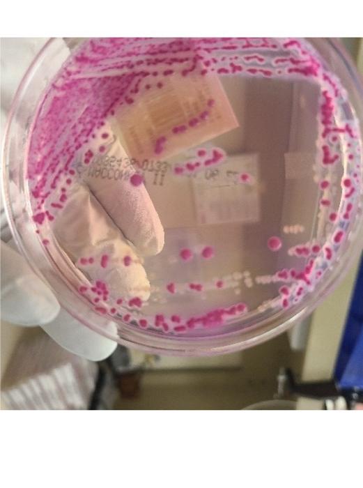 Solved PICTURE 1: Based on this CAMPY agar, is campylobacter | Chegg.com