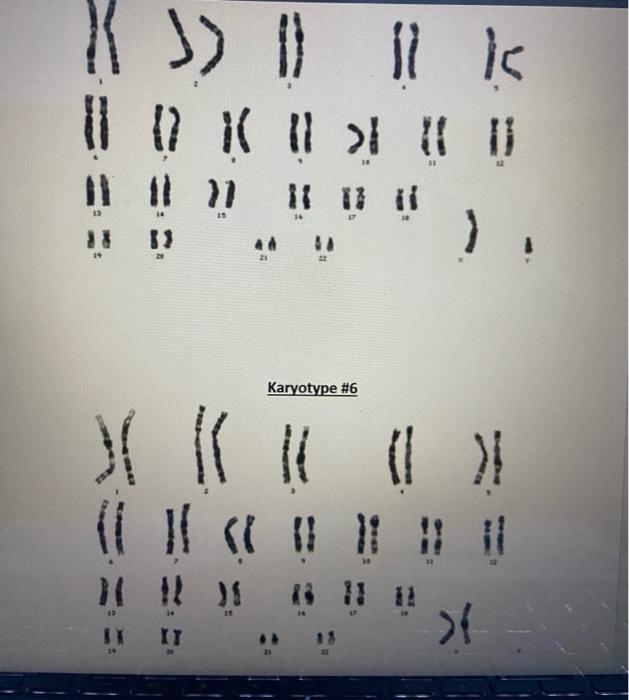 Solved Karyotype Lab NC Essential Standard 3.2.2 Predict | Chegg.com