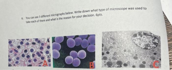 Solved 6. You can see 3 different micrographs below. Write | Chegg.com