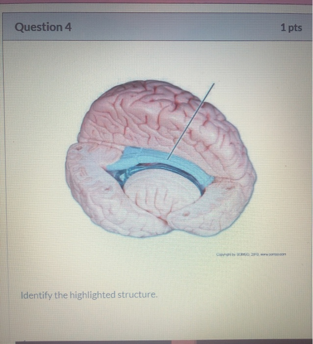 Solved Question 4 1 pts Identify the highlighted structure. | Chegg.com