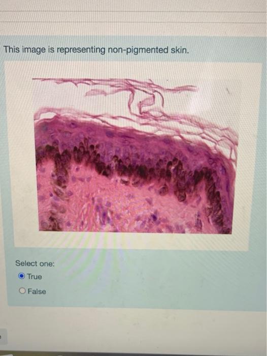 Solved This image is representing non-pigmented skin. Select | Chegg.com