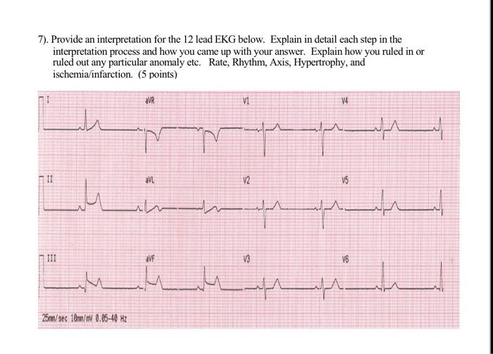 7). Provide an interpretation for the 12 lead EKG | Chegg.com