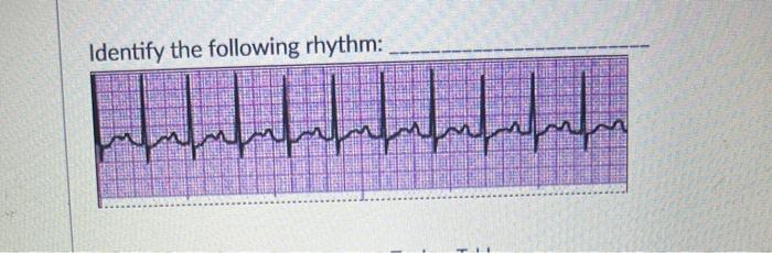 Solved Identify the following rhythm: | Chegg.com