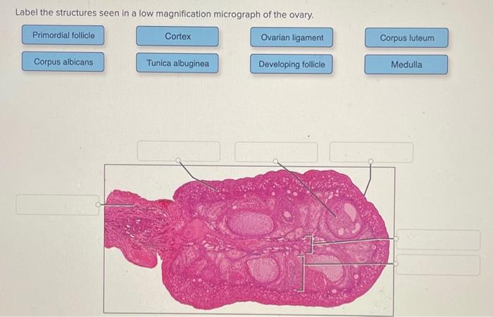 Solved Identify the superficial anatomical structures shown | Chegg.com