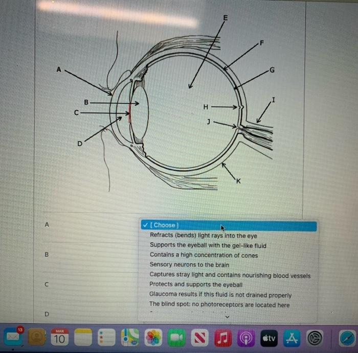 Solved [Choose] Refracts (bends) light rays into the eye | Chegg.com