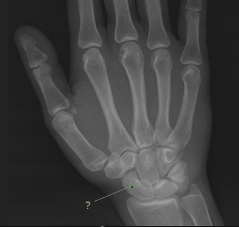 Solved identify the following structures that are pointed | Chegg.com