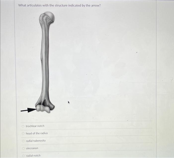 Solved What articulates with the structure indicated by the | Chegg.com