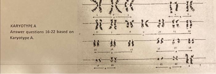 Solved KARYOTYPE A Answer questions 16-22 based on Karyotype | Chegg.com