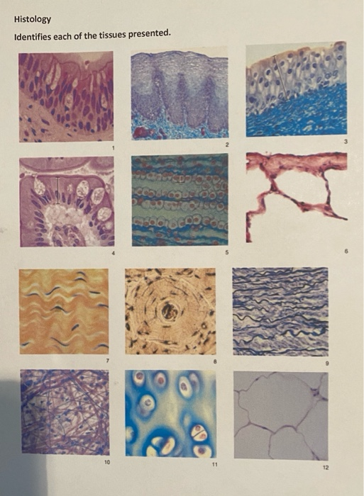 Solved Histology Identifies each of the tissues presented. | Chegg.com