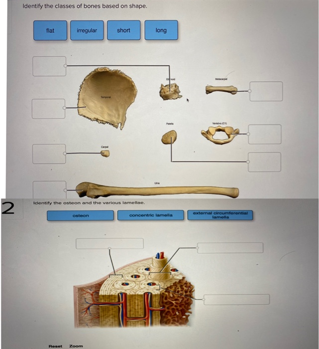 Solved Identify the classes of bones based on shape. flat | Chegg.com