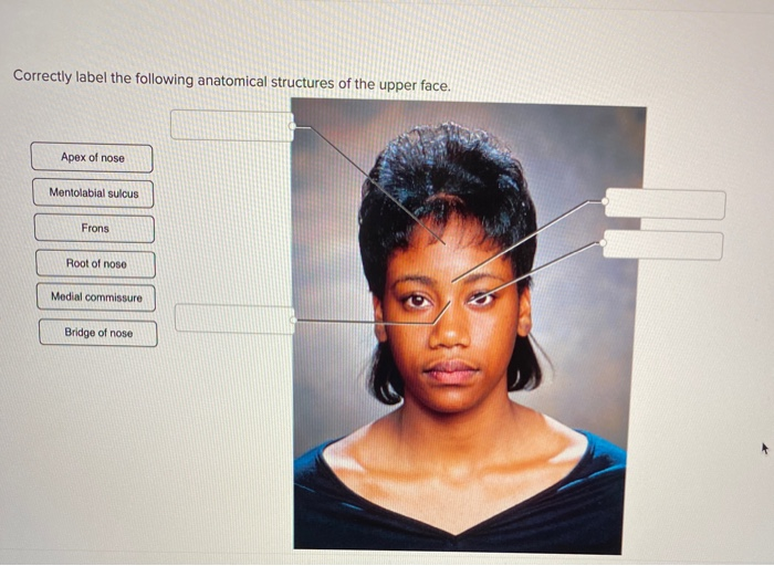 Solved Correctly label the following anatomical structures | Chegg.com