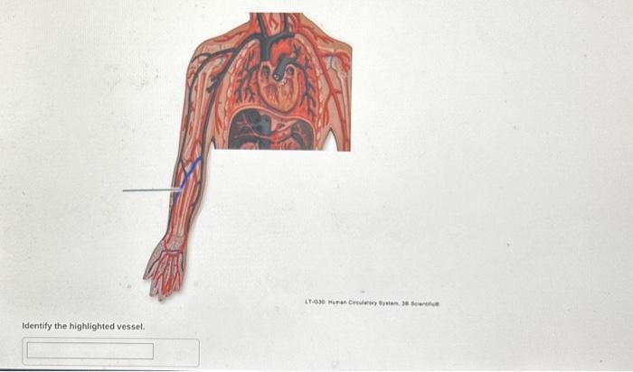 Solved fyolan 3e seantike Identify the highlighted vessel. | Chegg.com