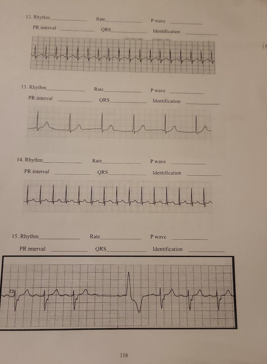 Solved 12. Rhythm Rate P wave PR interval QRS Identification | Chegg.com