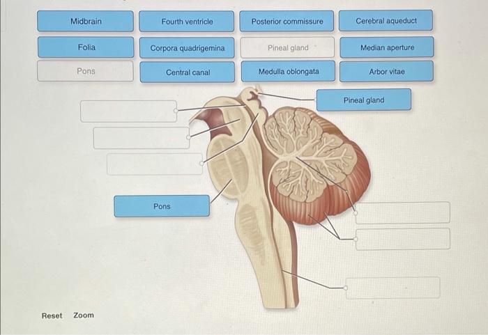 Solved 30V Identify the structures on this midsagittal view | Chegg.com
