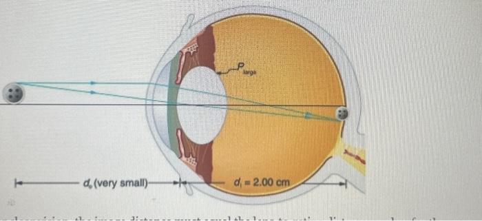 Solved What is the Refractive Power (Diopters) of the lens | Chegg.com