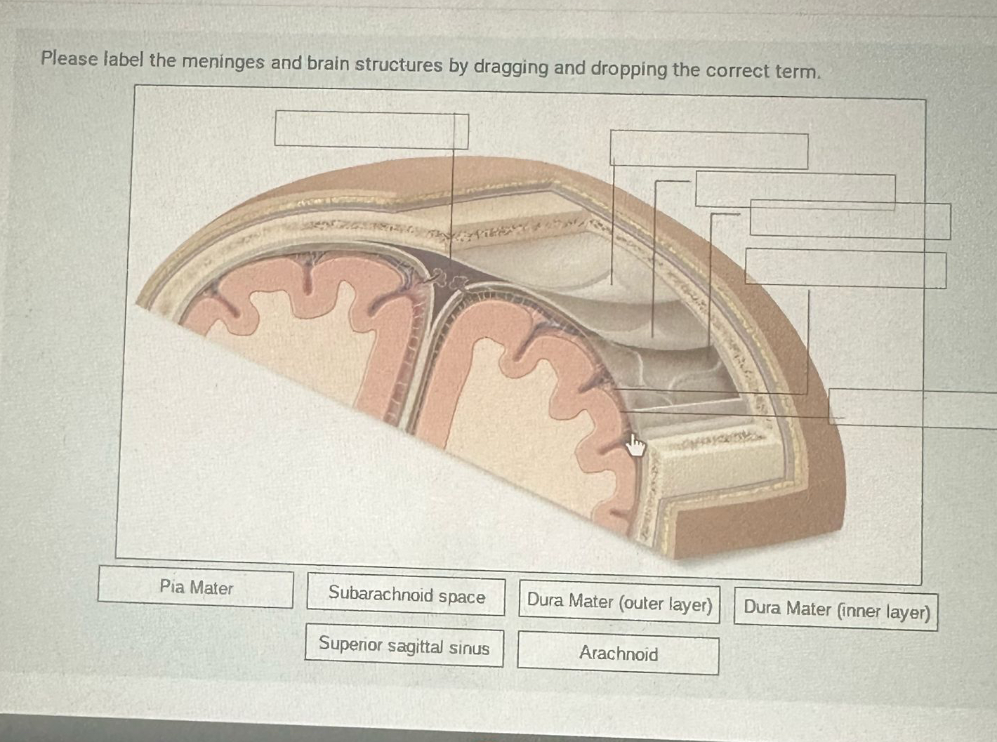 Solved Please label the meninges and brain structures by | Chegg.com