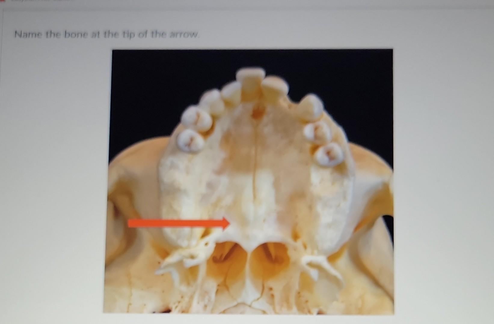 Solved Name the bone marker at the tip of the arrow. Name | Chegg.com