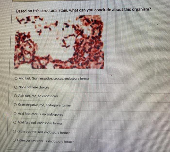 Solved Based on this structural stain, what can you conclude | Chegg.com