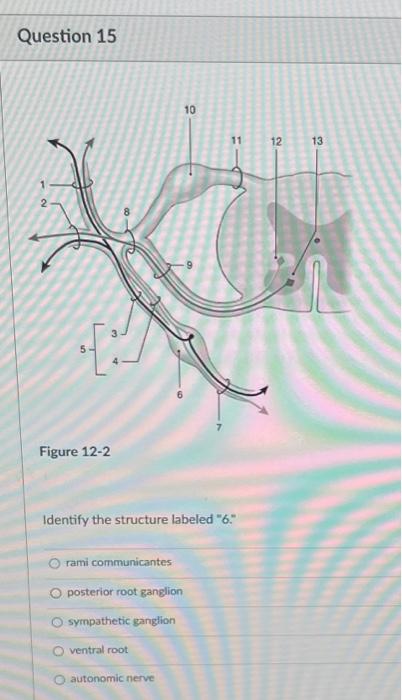 Solved Identify the structure labeled " 2 ." anterior ramus | Chegg.com