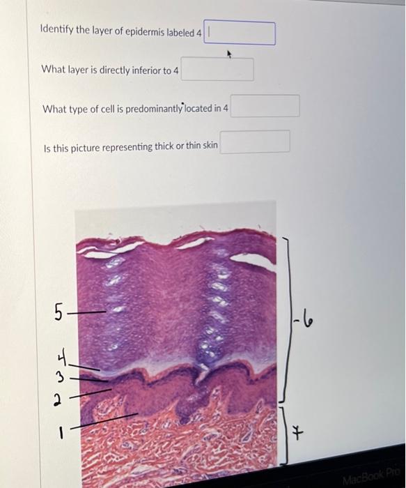 Solved Identify the layer of epidermis labeled 4 What layer | Chegg.com