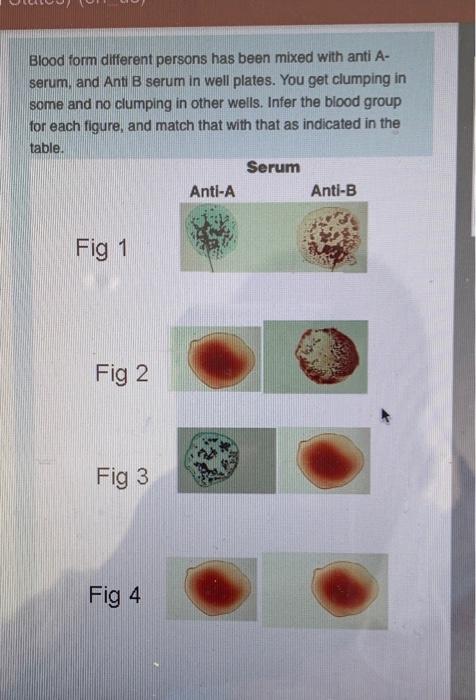 Solved Blood form different persons has been mixed with anti | Chegg.com