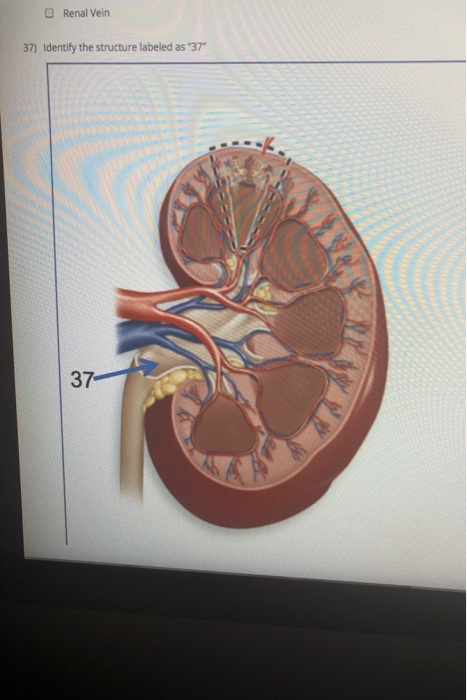 Solved Renal Vein 37) Identify the structure labeled as "37" | Chegg.com